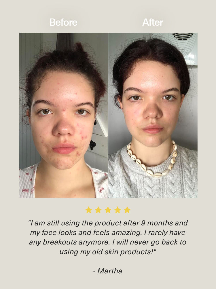 Red Algae skincare recovery & repair gel - Anti ageing cream – Seacra ...