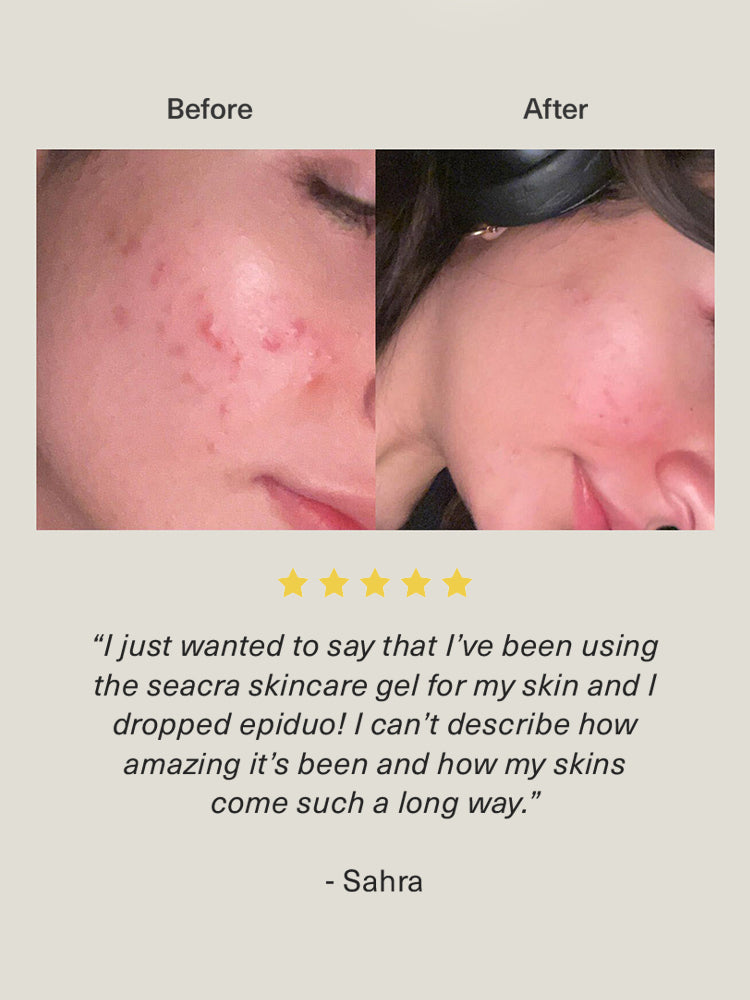 Red Algae skincare recovery & repair gel - Anti ageing cream – Seacra ...